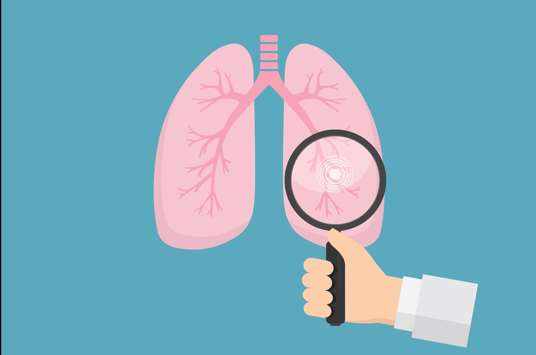 Kistik fibrozis nədir?