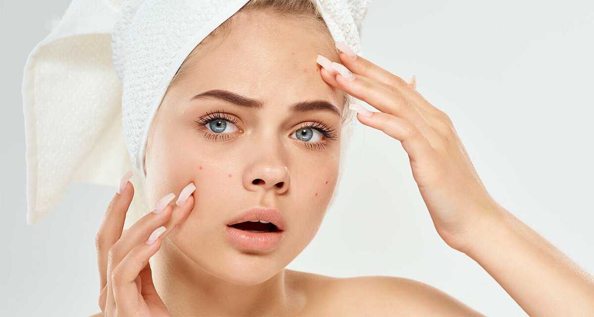 İltihablı sızanaq nədir?